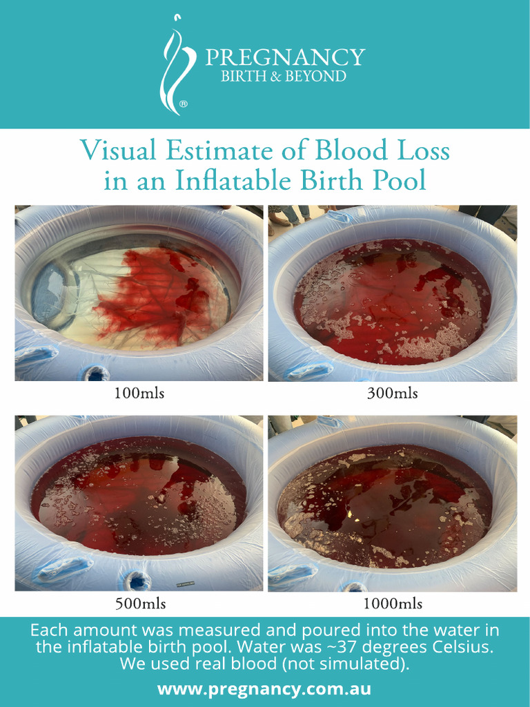 Estimating Blood Loss at Birth Visual Estimator | PDF