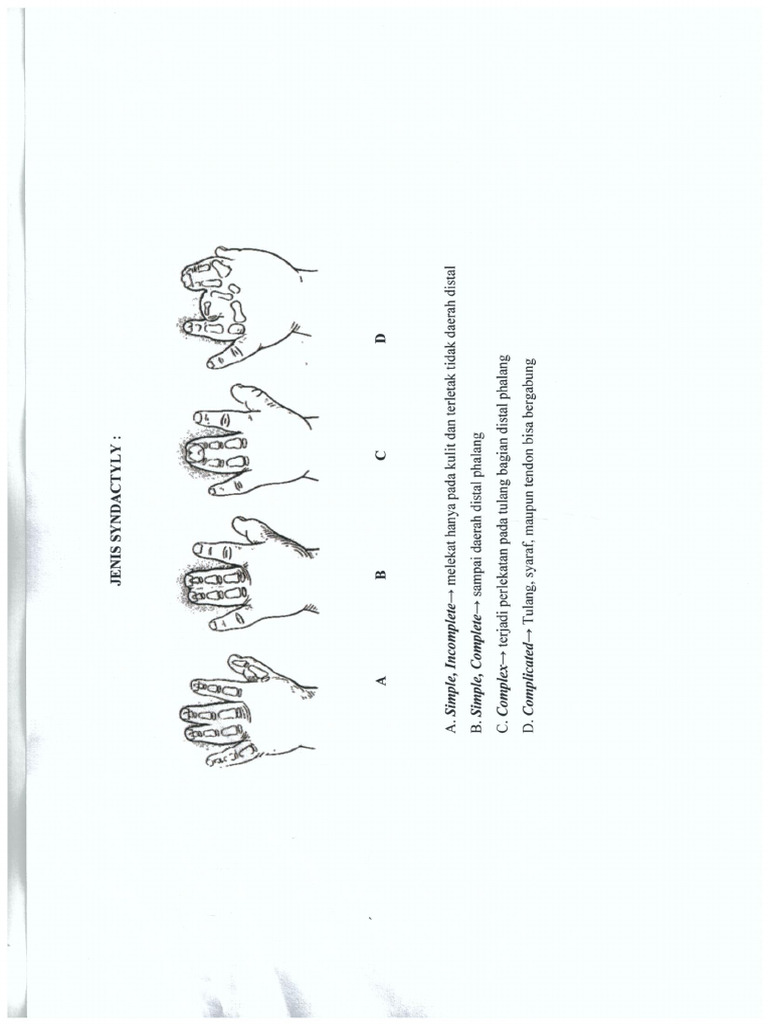 Types of Syndactily | PDF