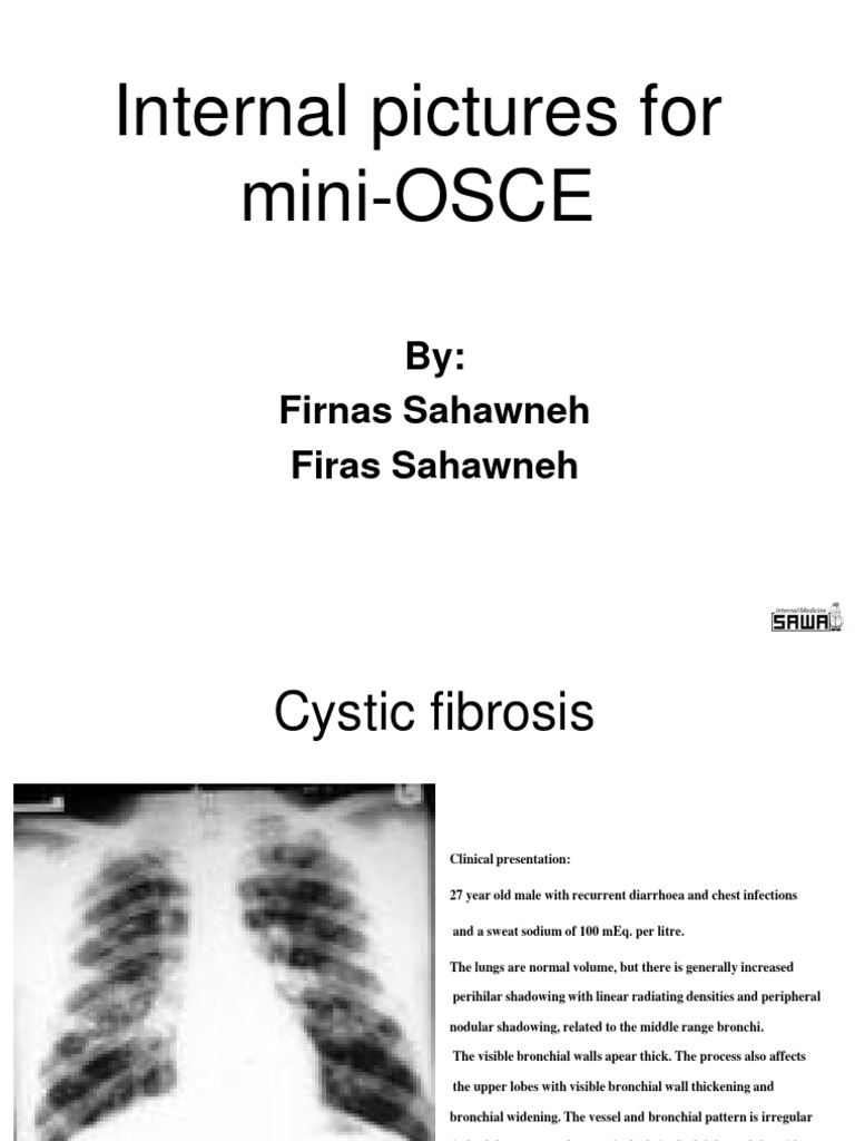 Mini-OSCE Internal Pictures | PDF | Anemia | Hepatitis