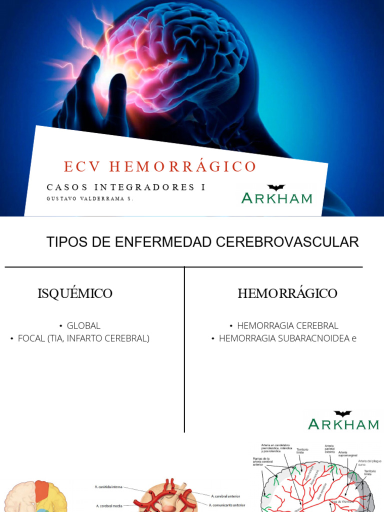 ECV Hemorrágico: Diagnóstico y Manejo | PDF | Medicina CLINICA ...