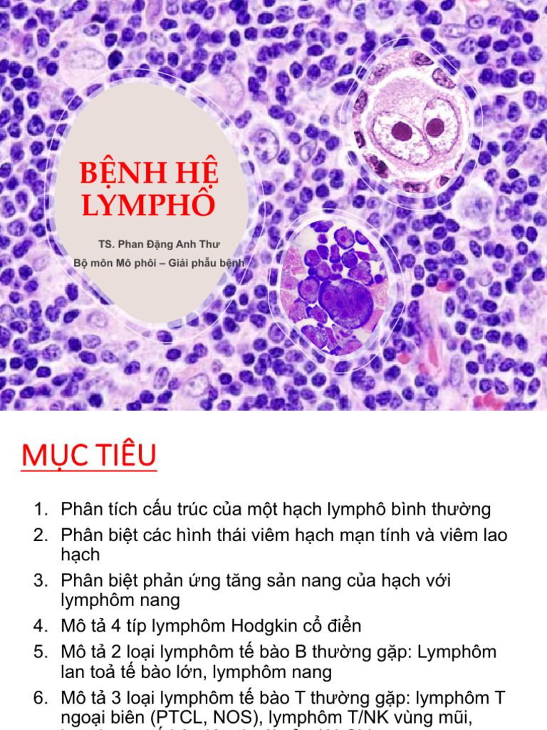 Bai Giang Benh Mo Limpho - CK1 UB DL TMH 2022 | PDF