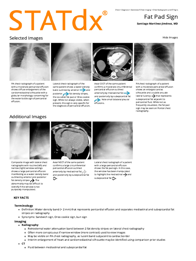 Fat Pad Sign - Print Friendly - STATdx | PDF | Radiography | Radiology