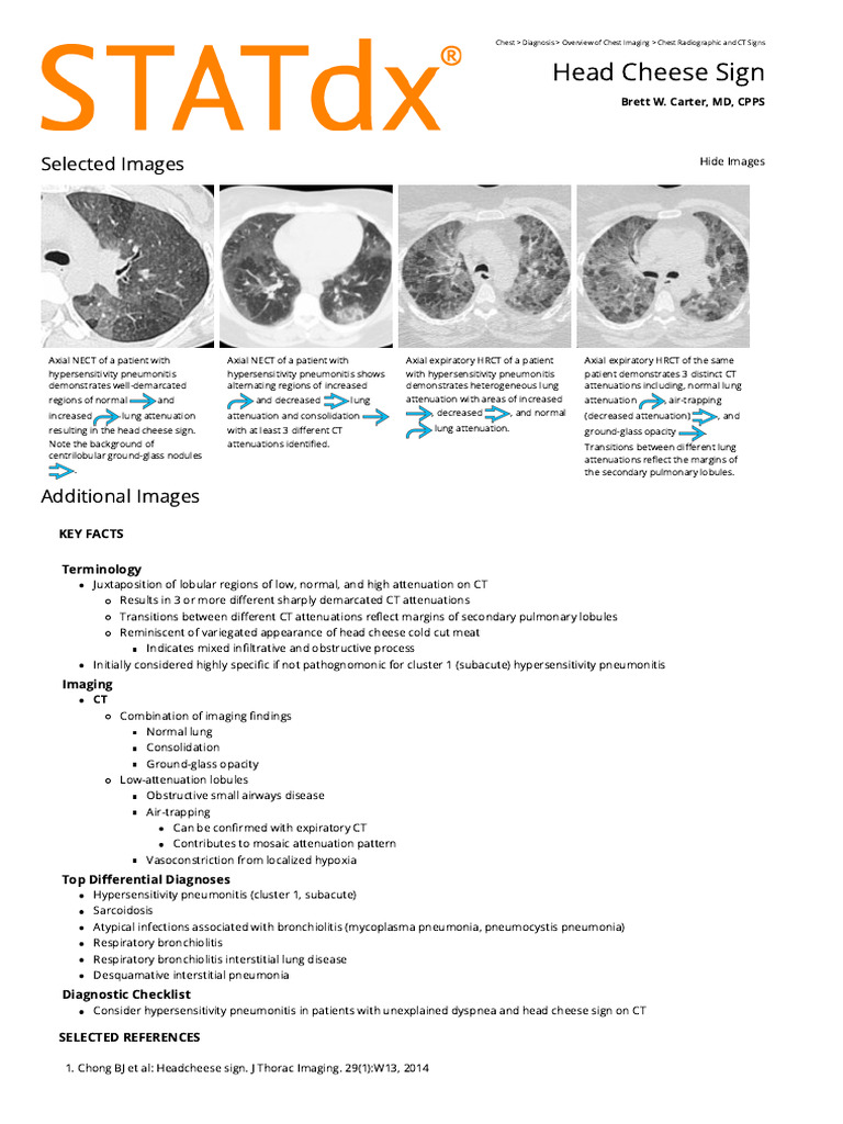 Head Cheese Sign - Print Friendly _ STATdx | PDF | Respiratory Diseases ...