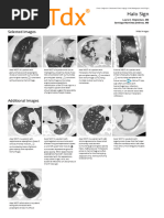 Head Cheese Sign - Print Friendly - STATdx | PDF | Respiratory Diseases ...