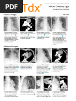 Head Cheese Sign - Print Friendly - STATdx | PDF | Respiratory Diseases ...