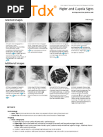 Head Cheese Sign - Print Friendly - STATdx | PDF | Respiratory Diseases ...