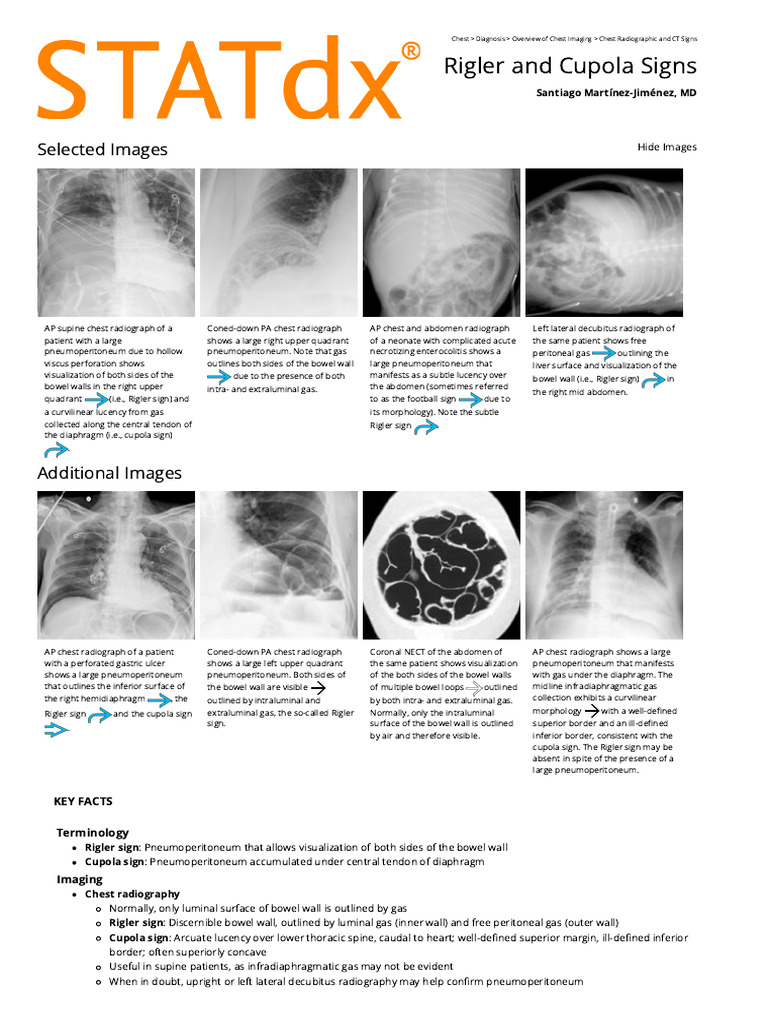 Rigler and Cupola Signs - Print Friendly - STATdx | PDF