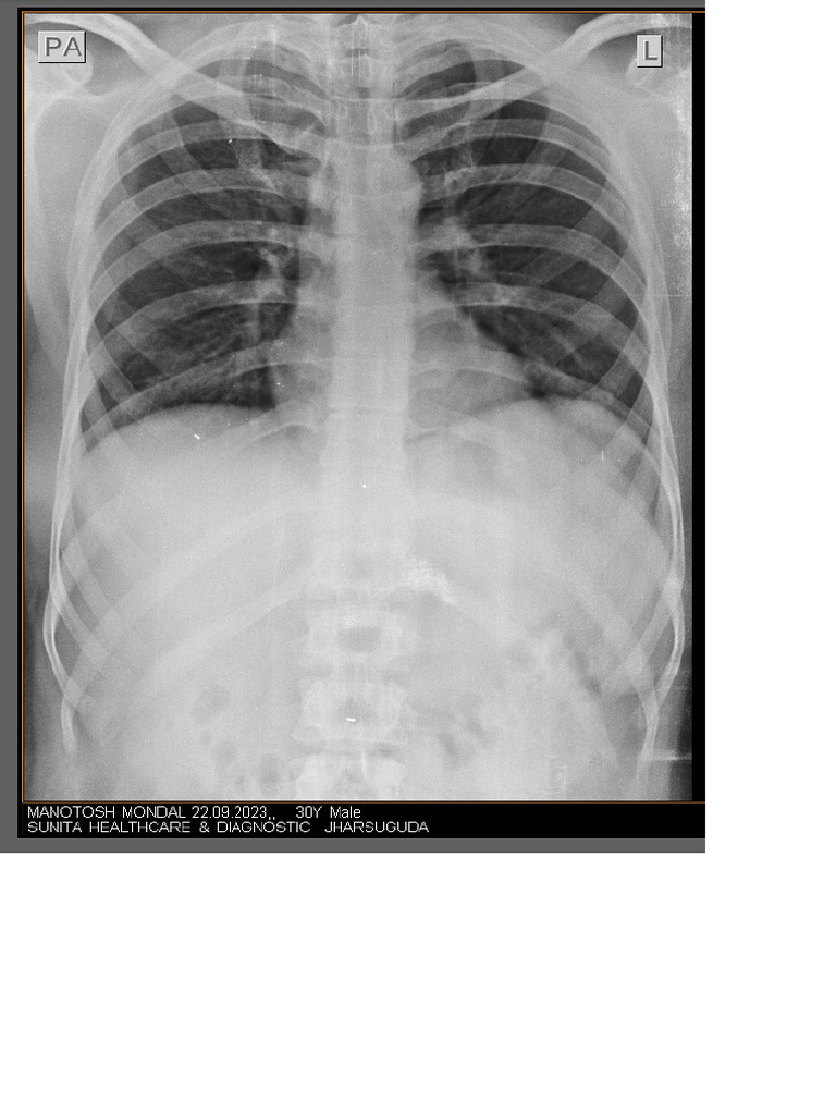 Manotosh Mondal Medical Reports | PDF