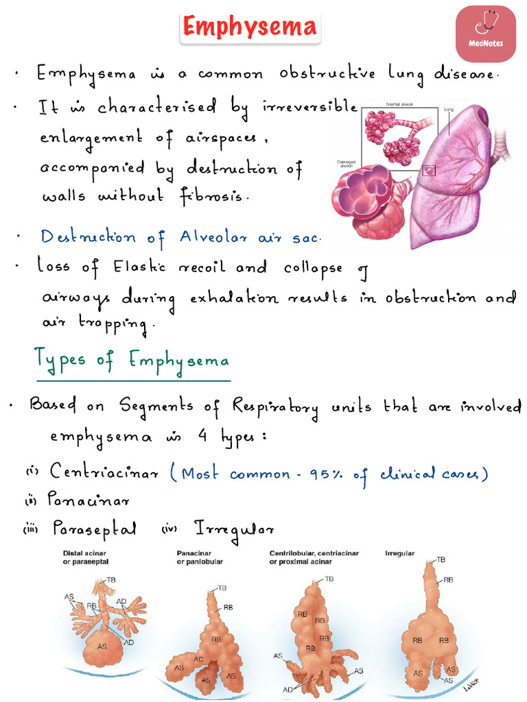 Emphysema | PDF