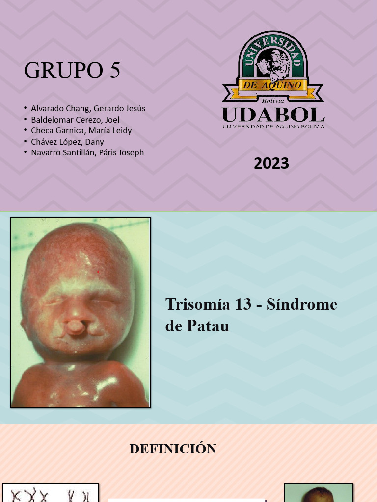 Trisomia 13 Sindrome de Patau | PDF | Medicina CLINICA | Enfermedades y ...