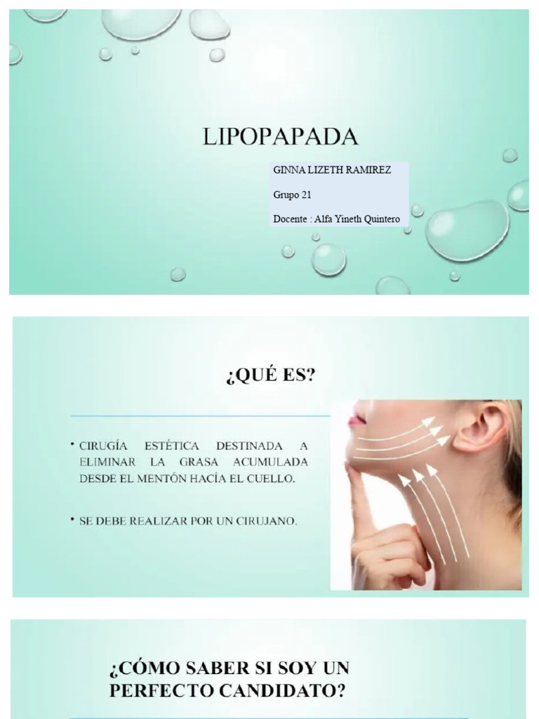 Presentacion LIPOPAPADA | PDF