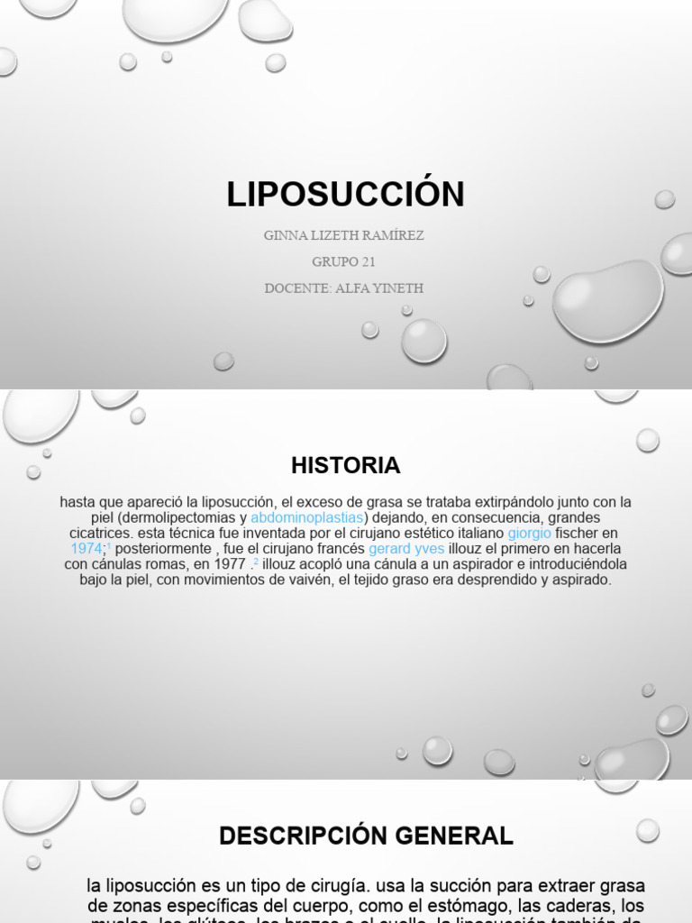 Presentacion Liposucción Pdf