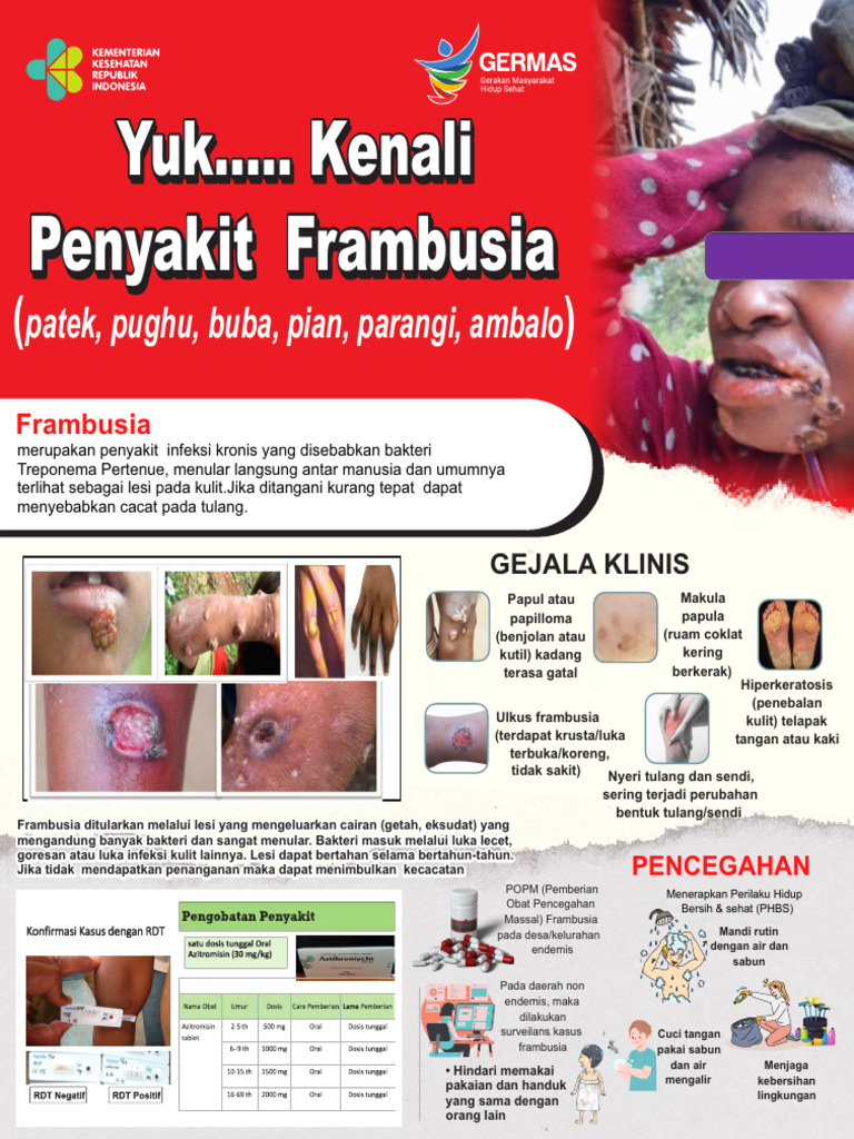 Kenali Penyakit Frambusia dan Pencegahannya | PDF