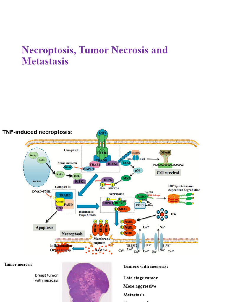 Necroptosis and Tumor Metastasis Insights | PDF | Necrosis | Cytotoxic ...