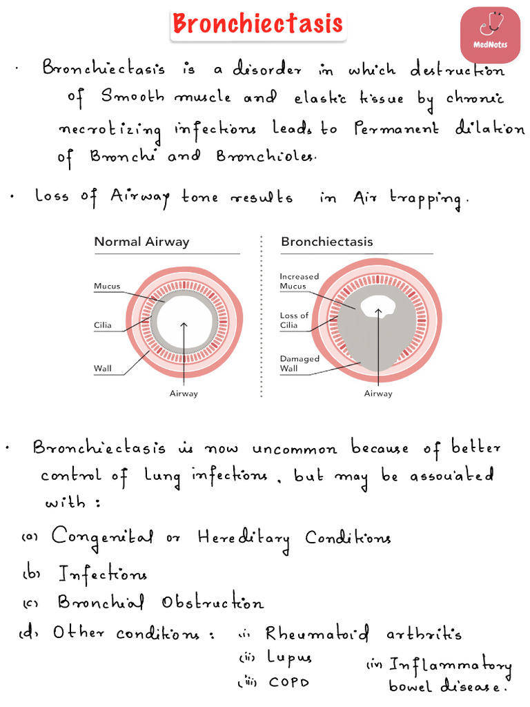 Bronchiectasis | PDF