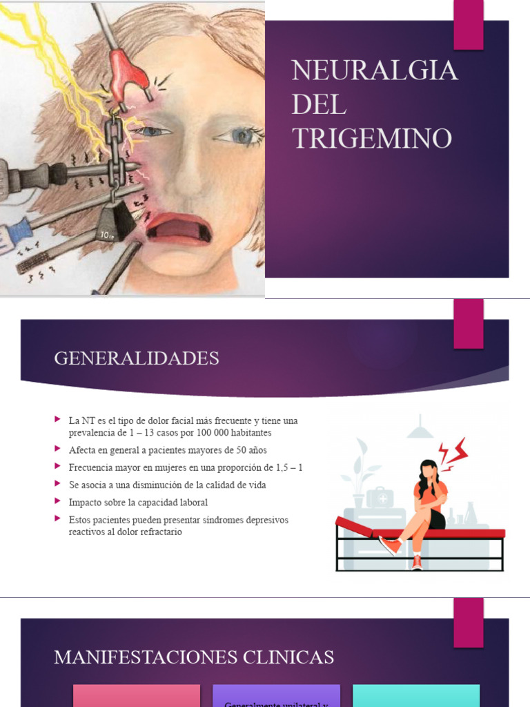 neuralgia-del-trigemino-pdf