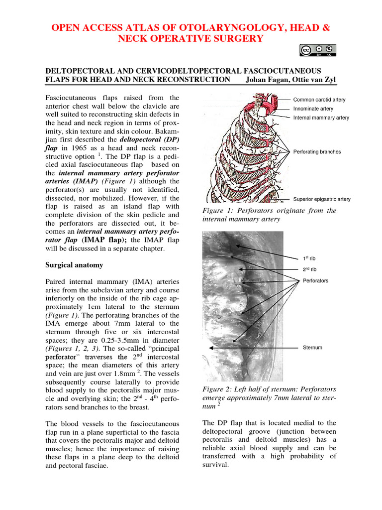 Deltopectoral Flap and Cervicodeltopectoral Fasciocutaneous Flaps For ...