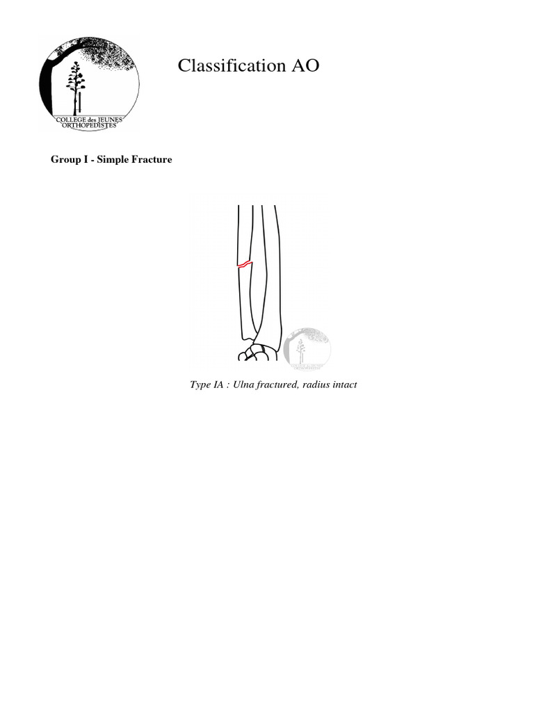 AO Fracture Classification Guide | PDF