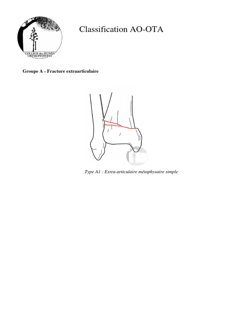 Classification Ao Ota Fract | PDF