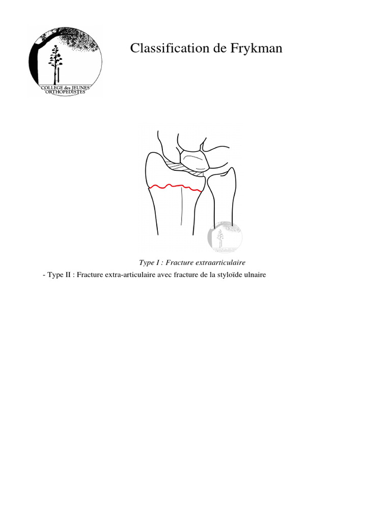 Classification de Frykman des fractures | PDF | Histoire