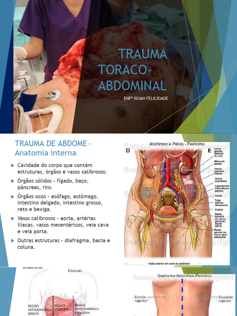 Trauma Toraco-Abdominal | PDF