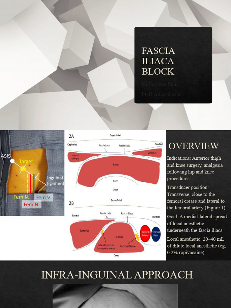 Fascia Iliaca Block | PDF