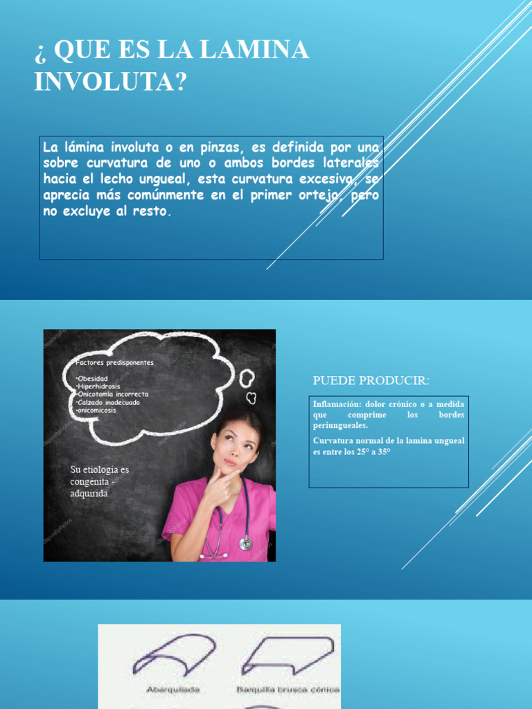 Lámina Involuta: Causas y Tratamiento | PDF