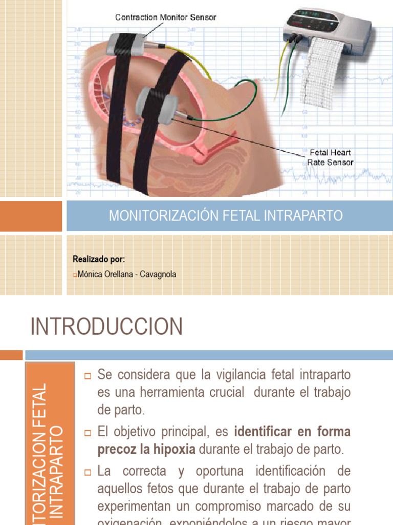 MEFI-2 | PDF | Parto | Feto