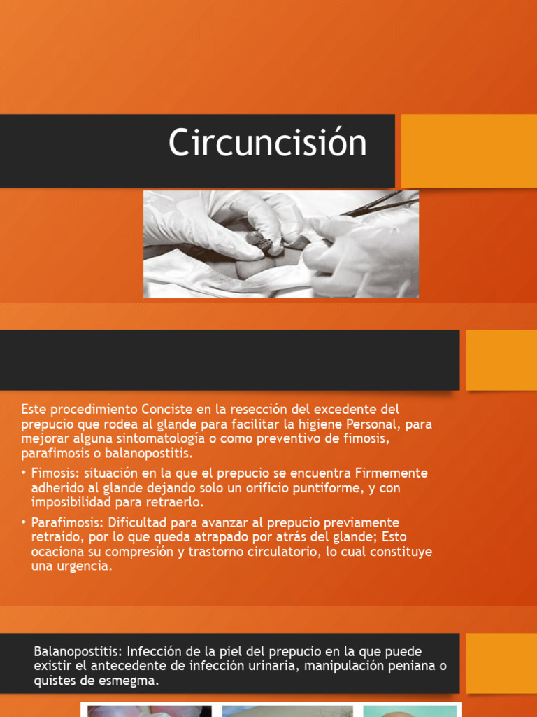 Tecnica QX Circuncisión | PDF