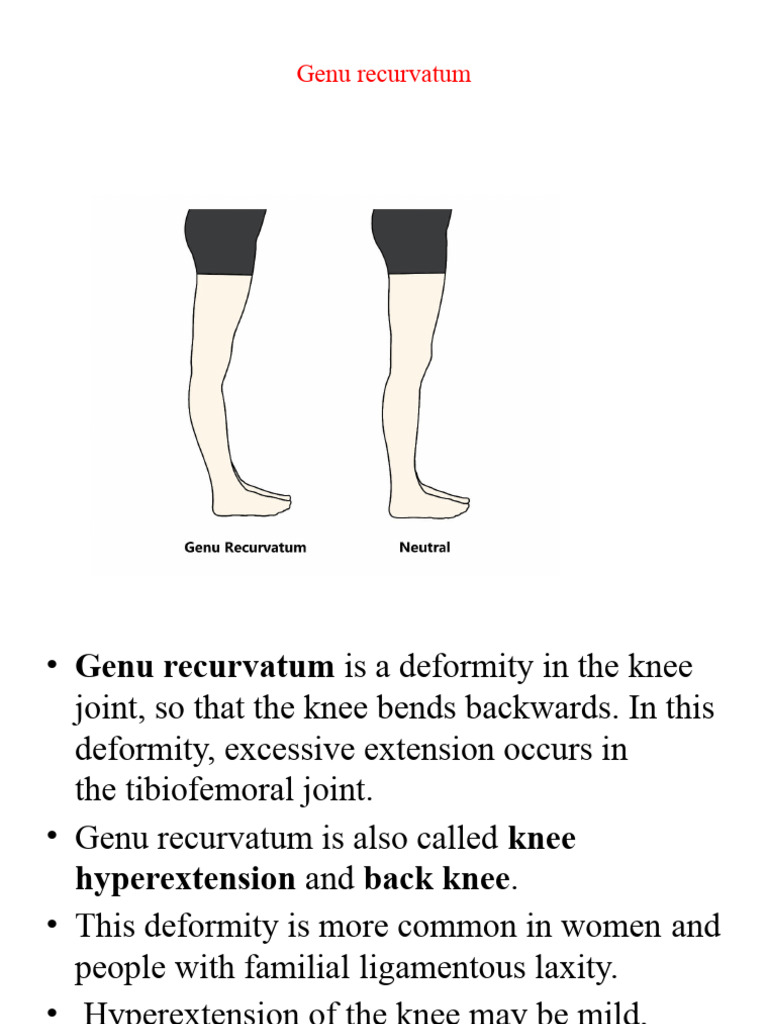Genu Recurvatum | PDF | Knee | Anatomical Terms Of Motion