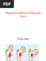 Coxa Vara and Coxa Valga | PDF | Hip | Skeletal System