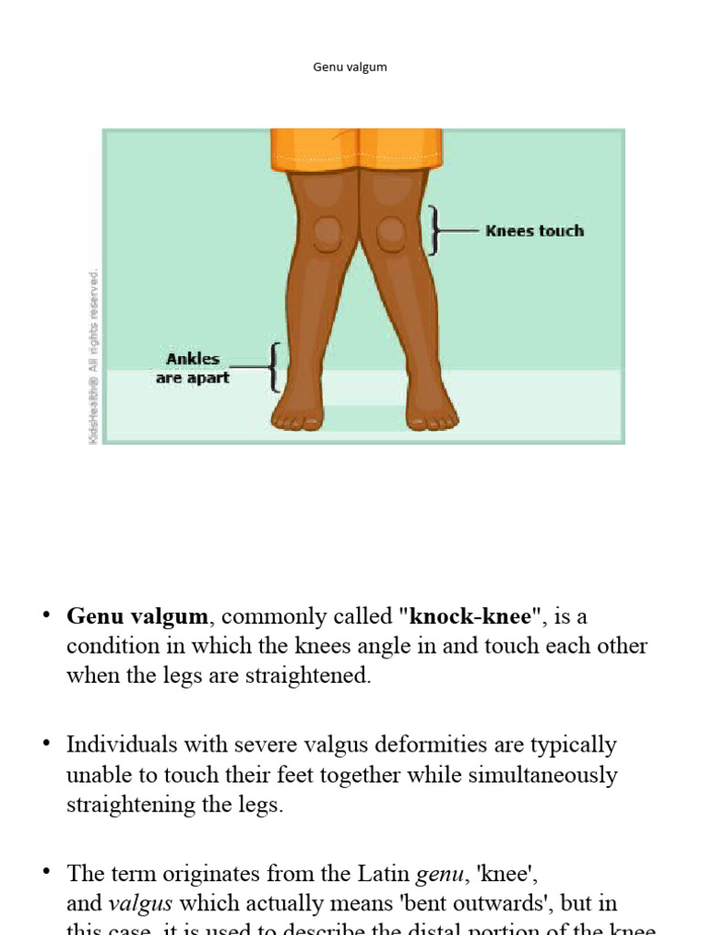 Genu Valgum & Varum | PDF | Skeletal System | Joints