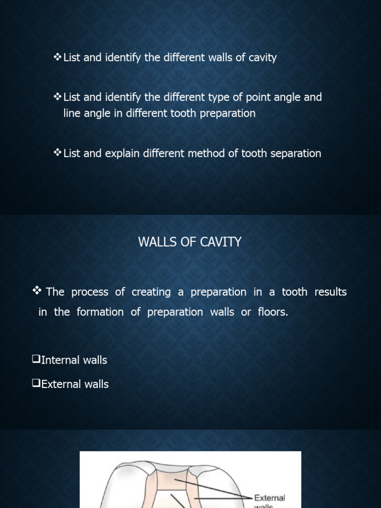 Walls, Line Angles | PDF