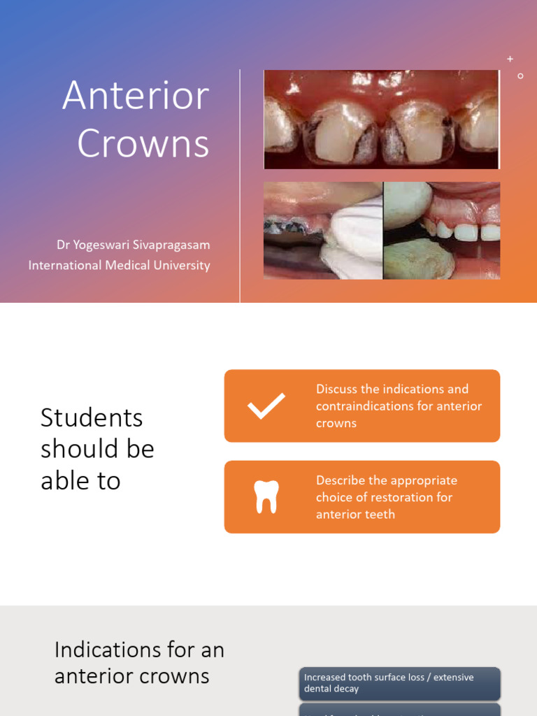 Anterior Crowns | PDF