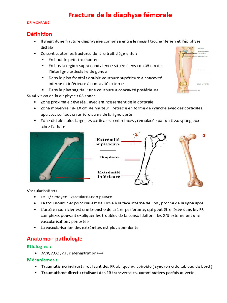 Fracture-de-la-diaphyse-fémorale | PDF