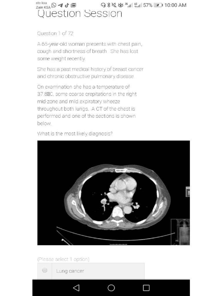 MRCP - PART ONE - ONExamination 2020 - Chest | PDF