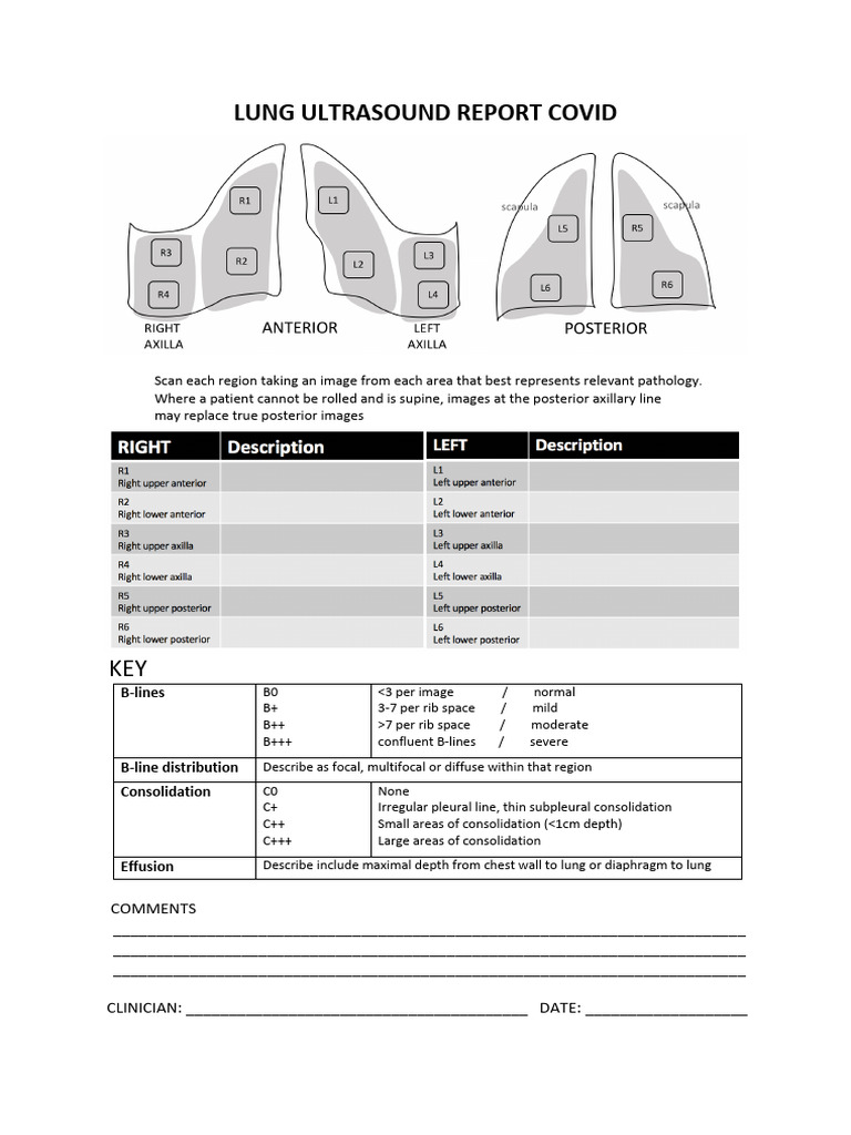 Lung Ultrasound Report Covid v2 | PDF