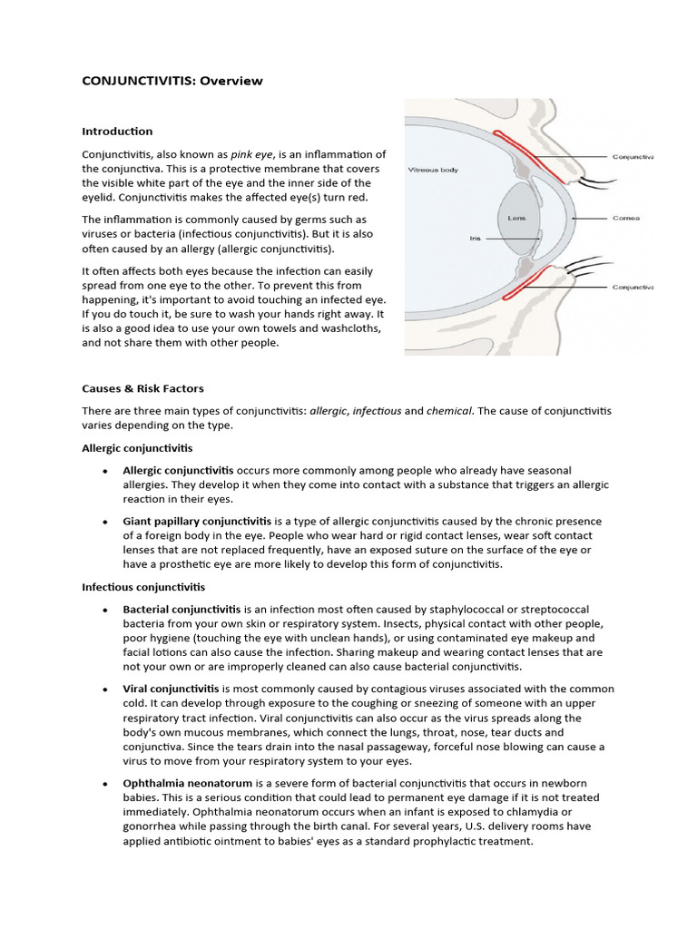 Conjunctivitis | PDF