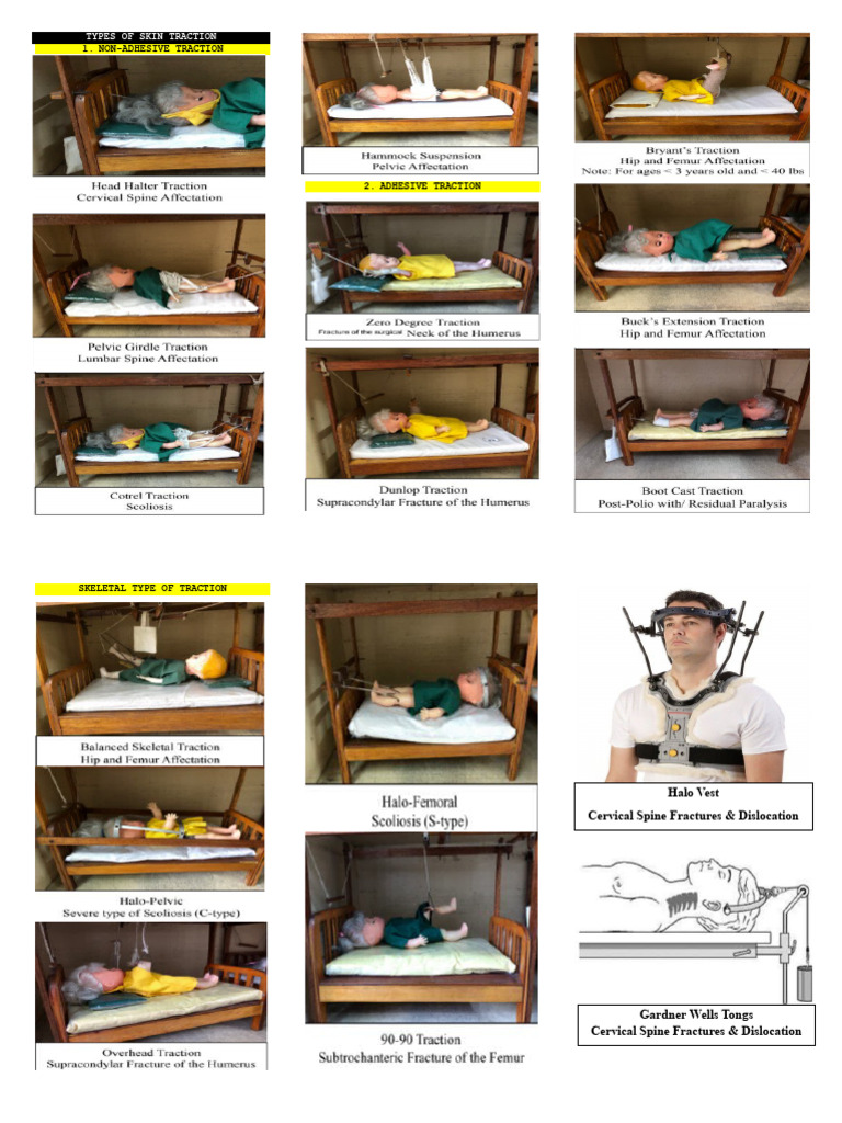 TRACTIONS-AND-CASTS | PDF