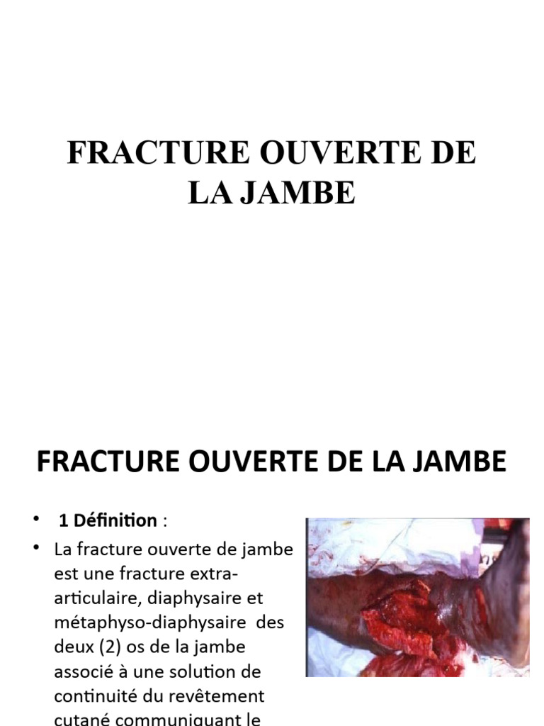 Fracture Ouverte de la Jambe : Guide Complet | PDF | Jambe humaine | Os