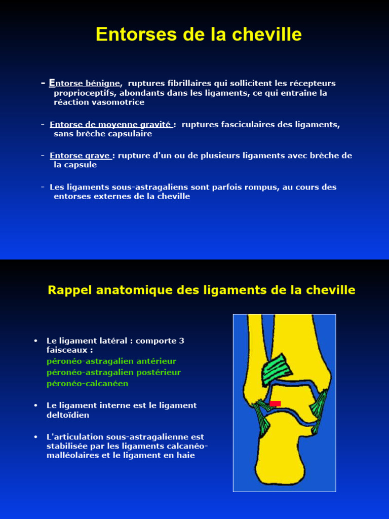 Entorses de la cheville : types et traitements | PDF | Cheville ...