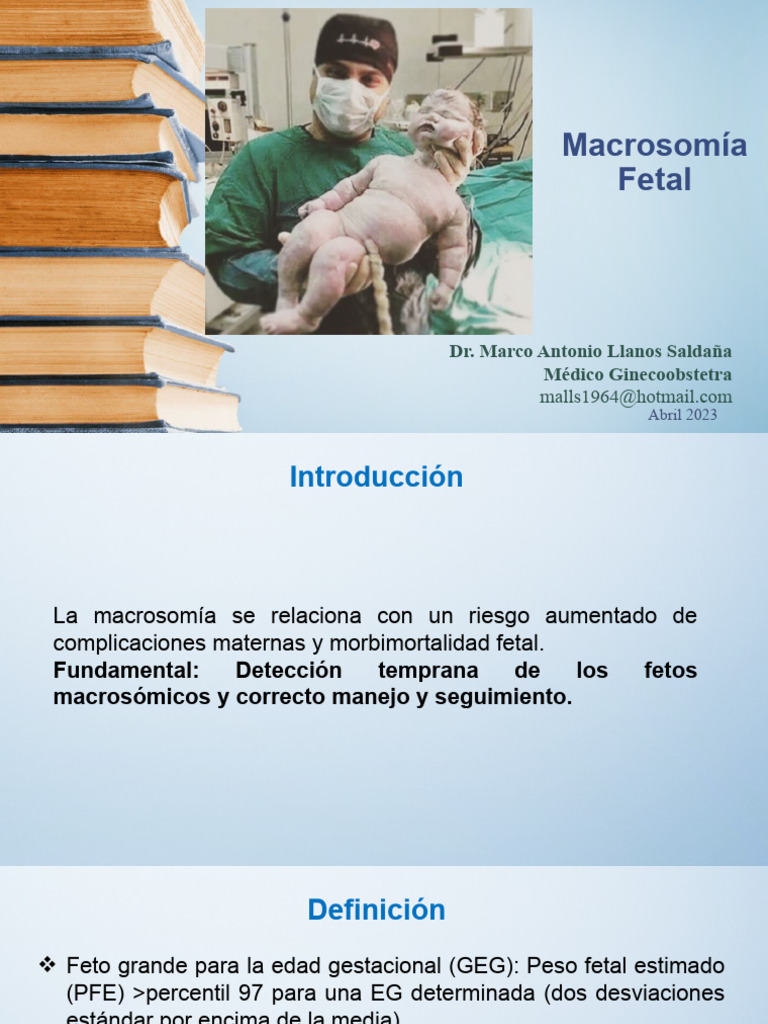 Sesion 16 Macrosomia Fetal | PDF