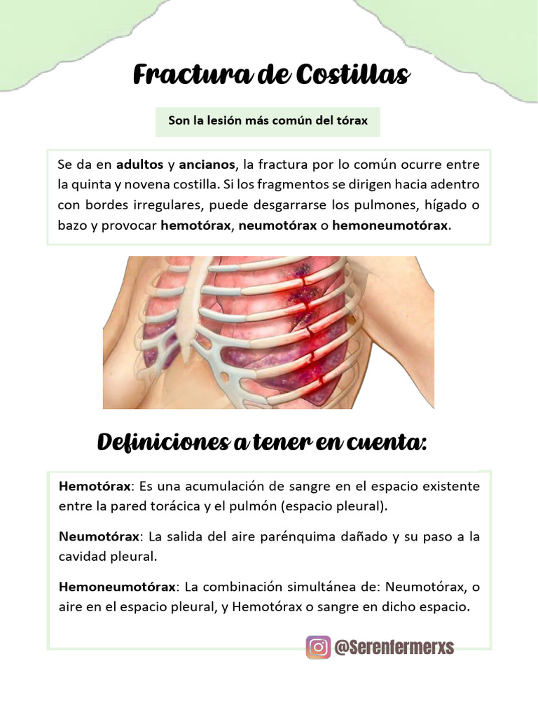 Fractura de Costilla A5 - SER ENFERMERXS | PDF