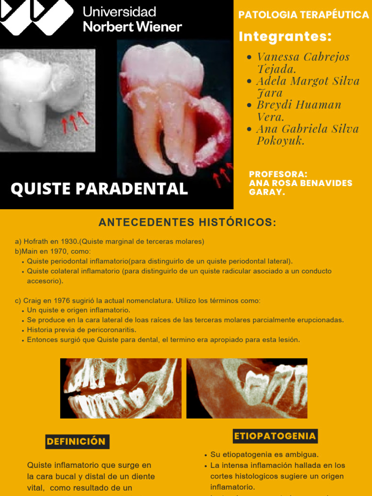 Quiste Paradental: Definición y Tratamiento | PDF