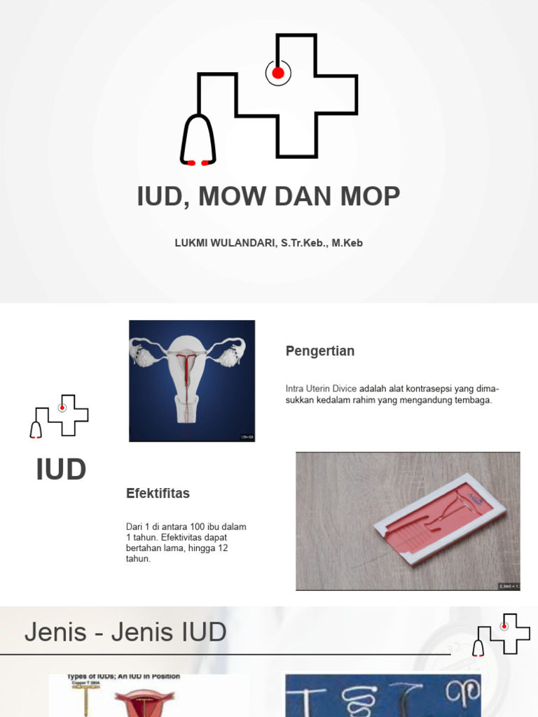 Metode Kontrasepsi: IUD, MOW, MOP | PDF