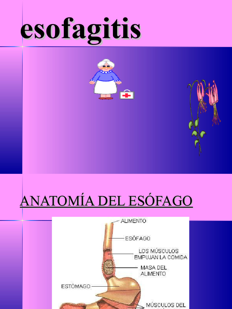 Esofagitis Pdf