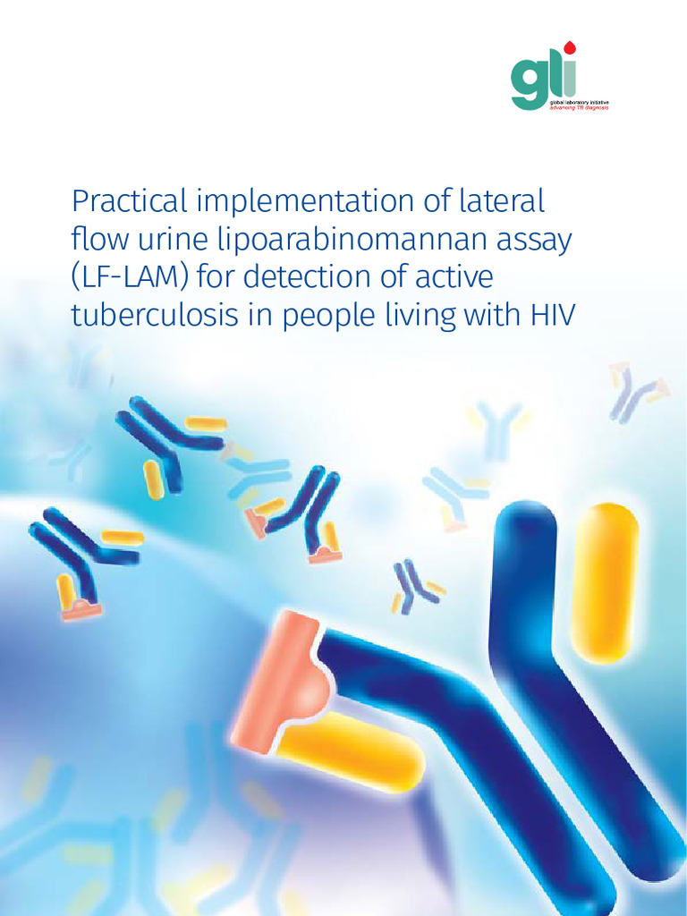 Practical Implementation LF Lam | PDF