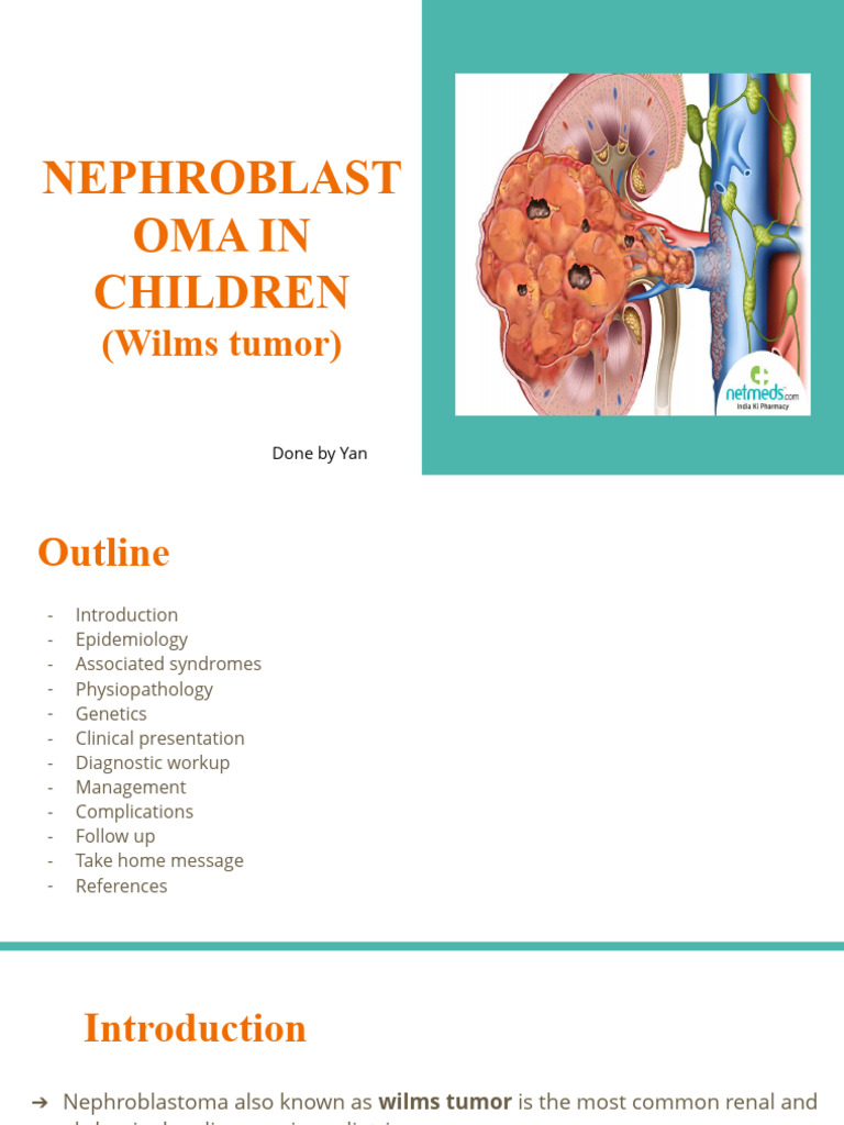 Nephroblastoma in Children (Wilm's Tumor) | PDF