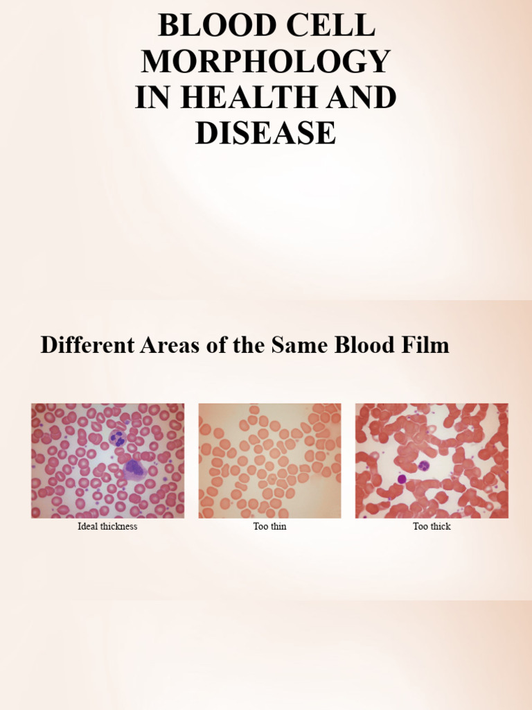 Blood Cell Morphology | PDF | Anemia | Red Blood Cell