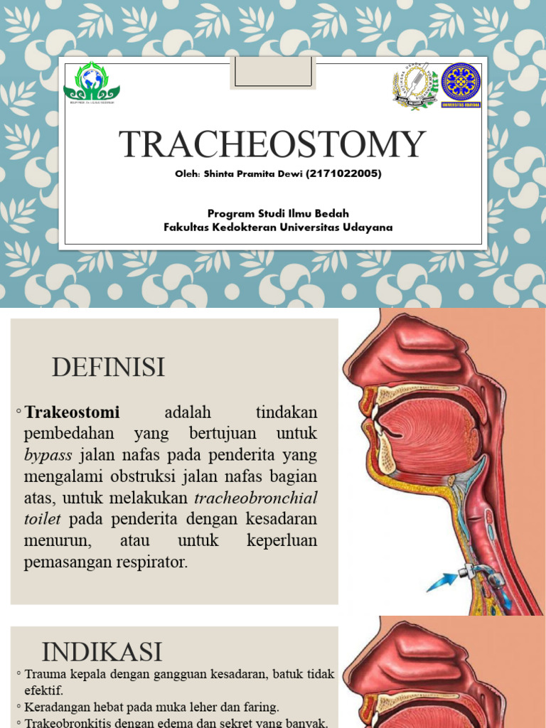 Trakeostomi | PDF